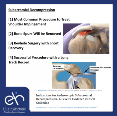 Subacromial Decompression - Dr. Hohmann, Consultant Orthopedic and ...